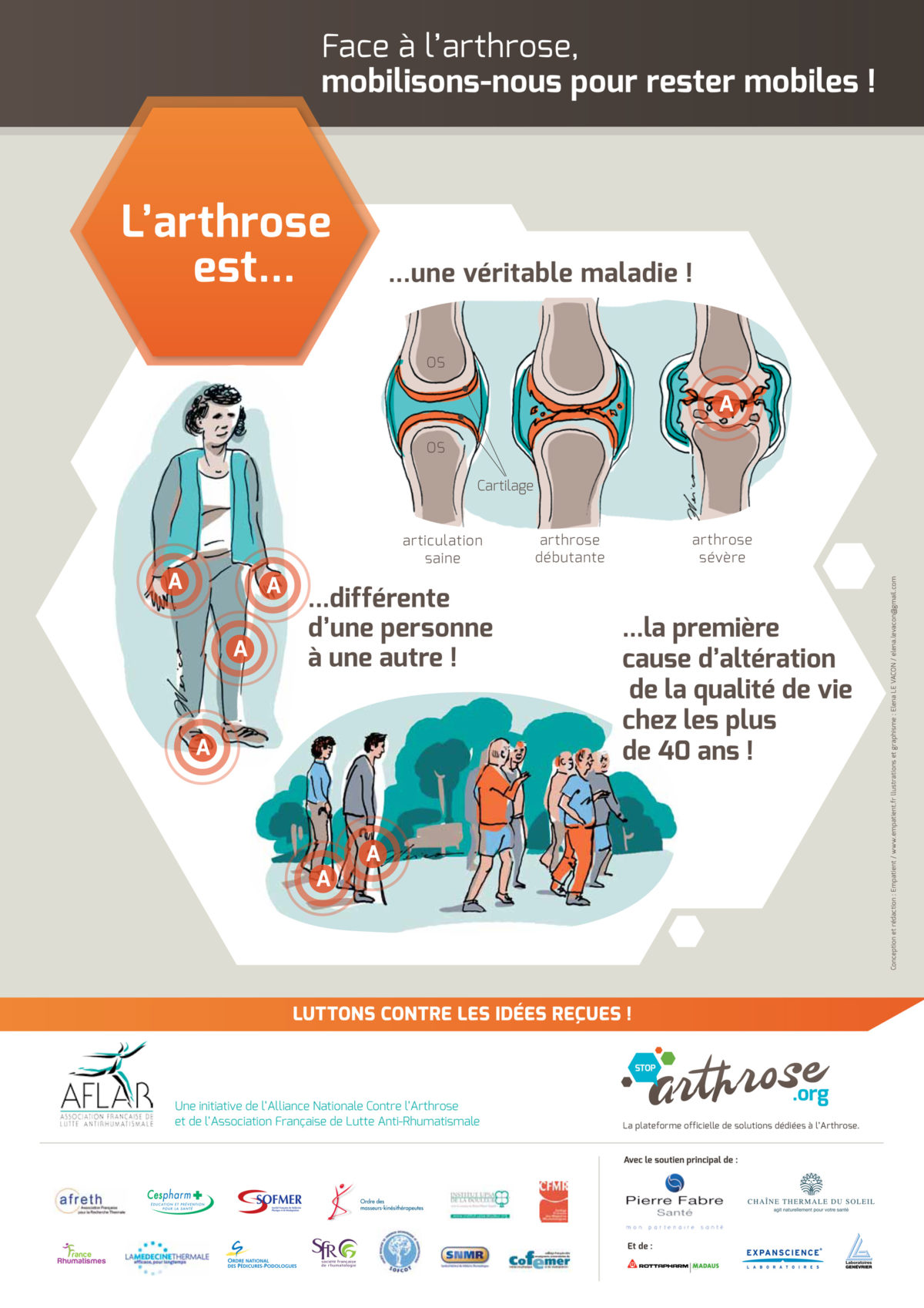 L'arthrose, une véritable maladie de l'articulation
